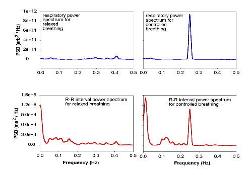ExPhys - Protocols, BME @ MTU